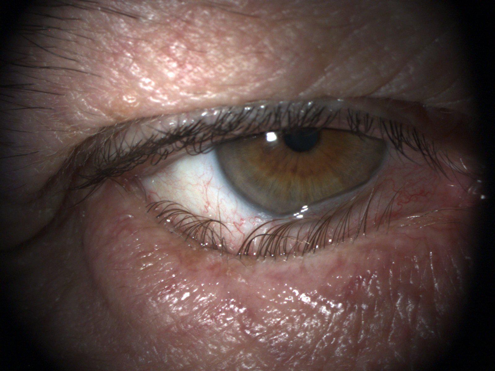 ENTROPION - Sevision